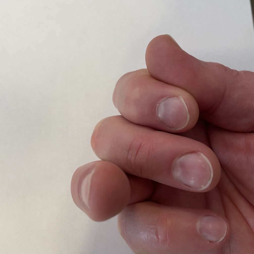 Finger Pick Sizing Instructions Selecting Your Pick Sizes - Tiptonic.com